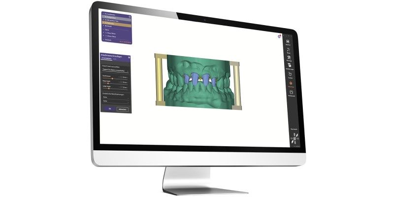 FINO DENTALART (powered by exocad) – Model Creator Modul | kurs005